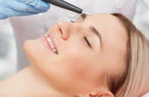 Electrolysis | Permanent Hair Removal | Dermal Beauty